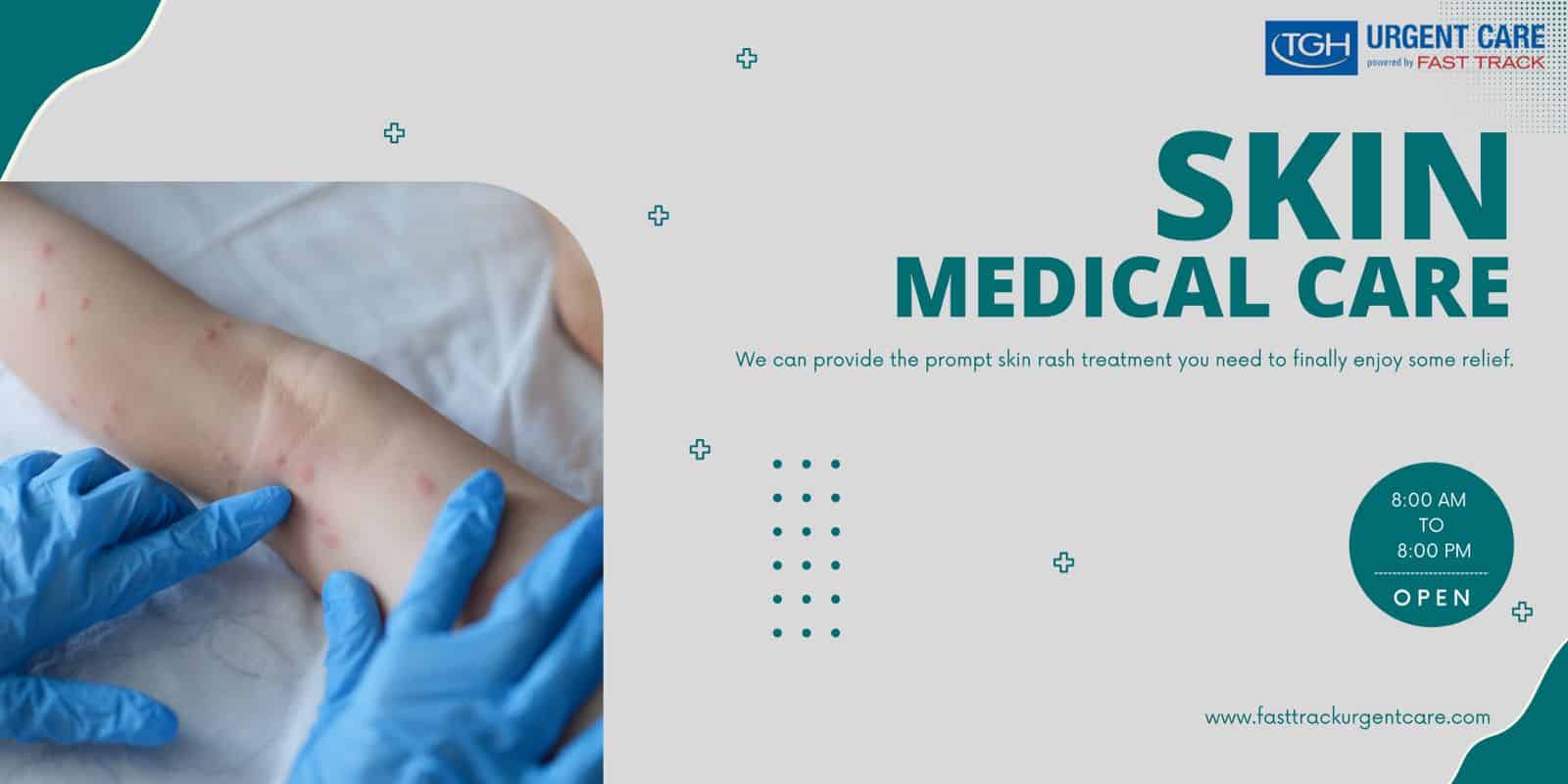 What Causes Rash and What Should You Do?