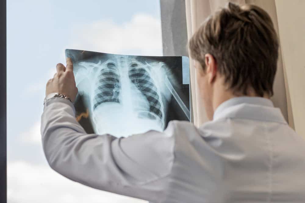 X-ray: The Benefits Of Urgent Care Diagnostics In Trinity, FL
